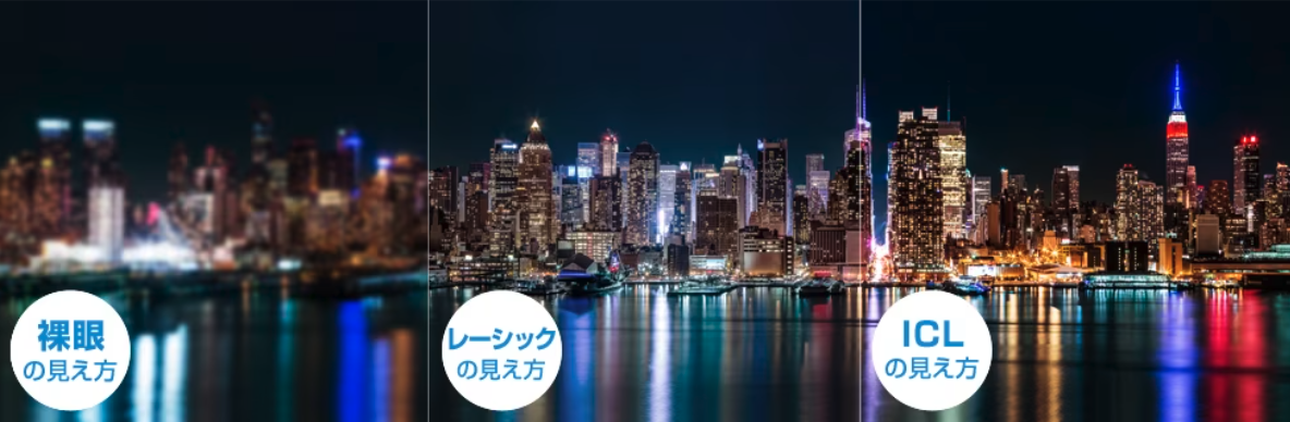 ICLとレーシックはどっちがいい？比較表で違いをわかりやすく解説 - CareNavi