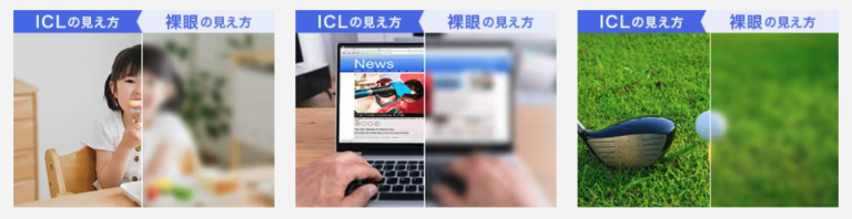 【ICLの名医】エキスパートインストラクターまとめ|在籍する眼科も紹介 - CareNavi